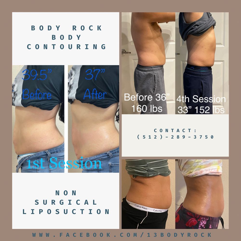 BODY ROCK BODY CONTOURING - Buda, Texas - Body Contouring - Phone ...