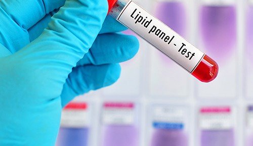 ACCU REFERENCE MEDICAL LAB - Updated February 2025 - 24 Park Ave, West ...