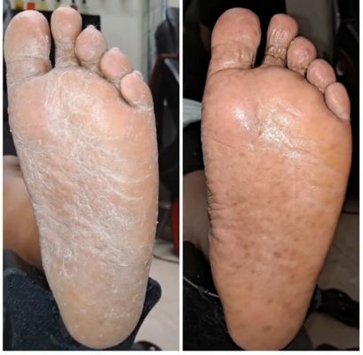 CHACHA FEET - Updated June 2025 - 17 Photos & 11 Reviews - 14917 Ambaum ...