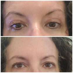 JEFFREY JOSEPH, MD - 36 Photos & 63 Reviews - Cosmetic Surgeons - 5010 ...