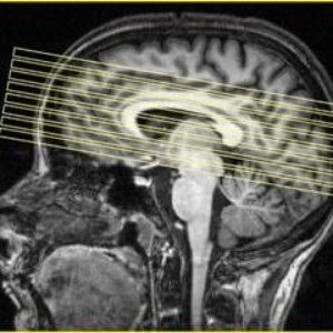 TOWER IMAGING VALENCIA - Updated December 2025 - 26 Photos & 155 ...