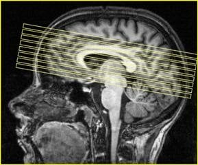 TOTAL IMAGING & OPEN MRI - Updated October 2025 - 44 Reviews - 18560 ...