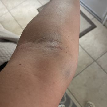 BIOLIFE PLASMA SERVICES - Updated August 2025 - 61 Photos & 240 Reviews ...