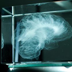 SPECTRUM MRI IMAGING CENTER - 18 Photos & 30 Reviews - Diagnostic ...