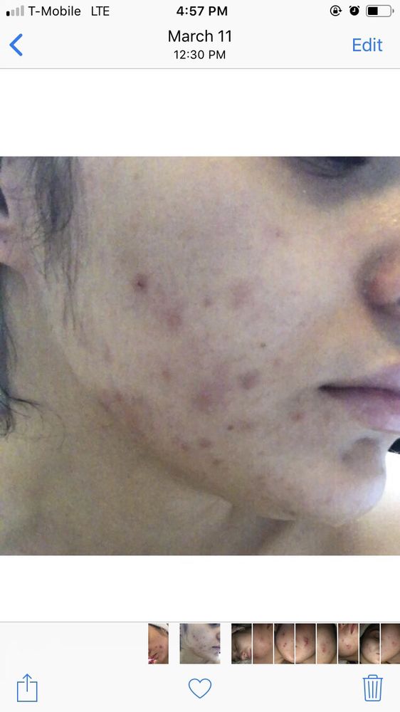 ACNE CLINIC NYC - 105 Photos & 57 Reviews - 108 W 39th St, New York ...