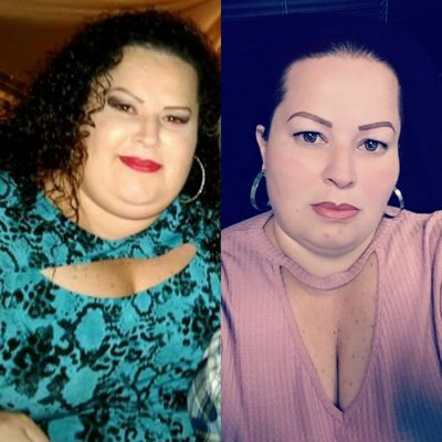 ATIF IQBAL MD - NEW LIFE SURGERY - Updated October 2025 - 56 Photos ...