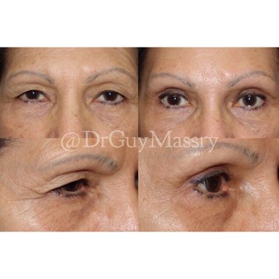 GUY MASSRY, MD - Updated December 2025 - 154 Photos & 176 Reviews - 150 ...