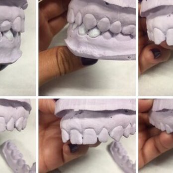 STEVE TASSONE, DDS - Updated December 2024 - 31 Photos & 71 Reviews ...