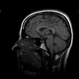 PREFERRED OPEN MRI - Updated November 2025 - 14 Photos - 4200 W 63rd St ...