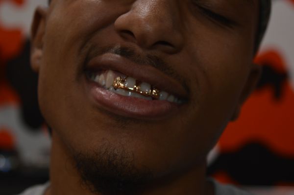 BALTIMORE GOLD FRONTS - Updated January 2025 - 85 Photos - 110 N Eutaw ...