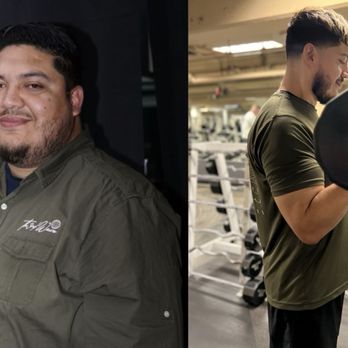 ATIF IQBAL MD - NEW LIFE SURGERY - Updated January 2026 - 56 Photos ...