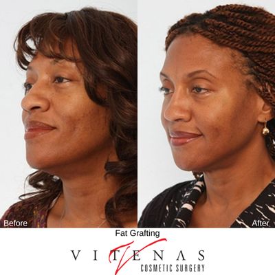 VITENAS COSMETIC SURGERY with photos - Updated August 2024 - 177 Photos ...