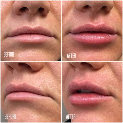 JOHN J. COREY, MD - AESTHETIC PLASTIC SURGERY - Updated December 2025 ...