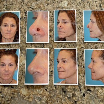 DAVID A. HECHT, MD - Updated December 2025 - 33 Photos & 45 Reviews ...