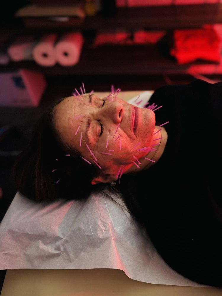 CHOICE ACUPUNCTURE - Updated December 2025 - 81 Photos & 32 Reviews ...