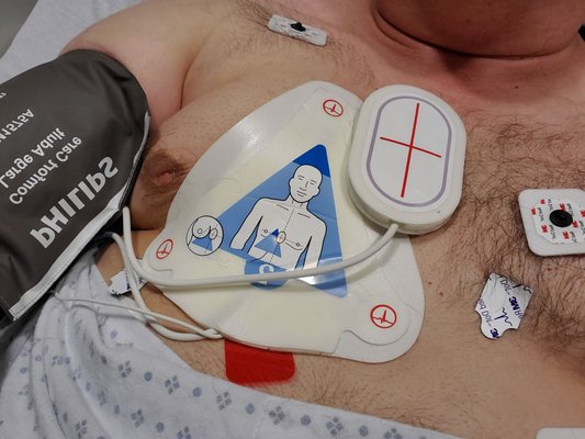 COMMUNITY HOSPITAL OF THE MONTEREY PENINSULA - 108 Photos & 222 Reviews ...