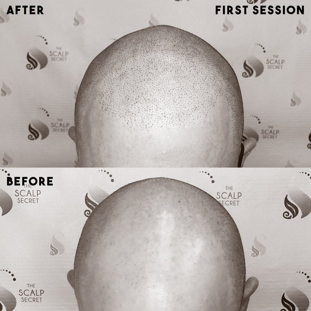 THE SCALP SECRET - Updated June 2024 - 72 Photos - 9340 W Tropicana Ave ...