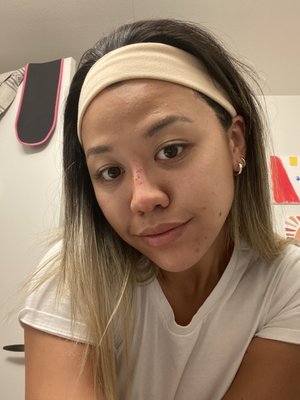 ALLURE ESTHETIC - Updated May 2025 - 59 Photos & 127 Reviews - 600 ...