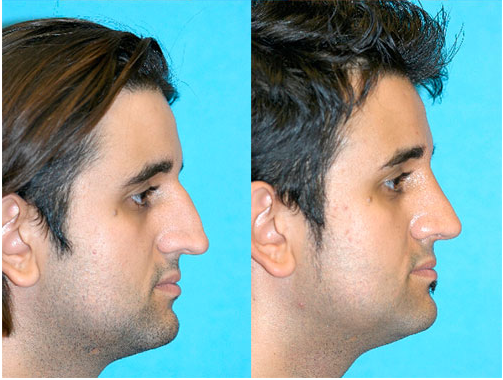 DAVID A. HECHT, MD - Updated December 2025 - 33 Photos & 45 Reviews ...