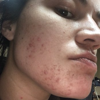 SCHWEIGER DERMATOLOGY GROUP- MILFORD - Updated January 2026 - 12 ...