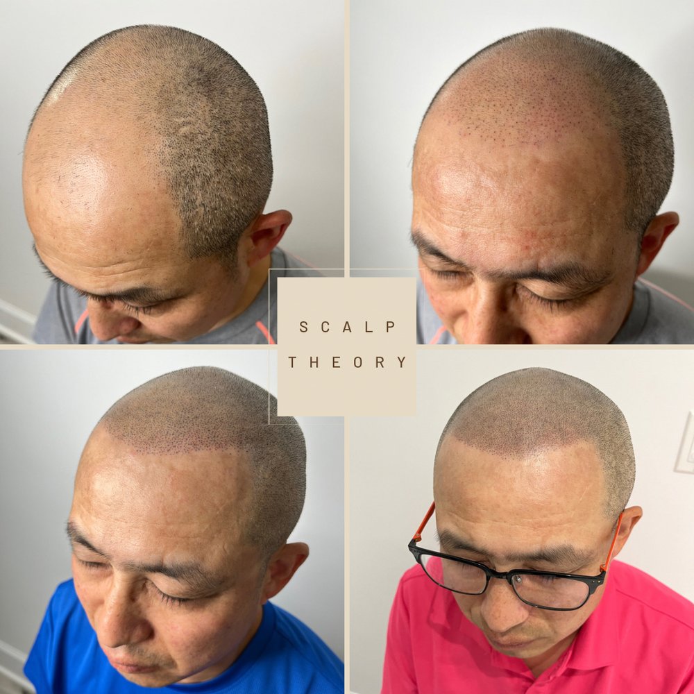 Scalp Theory Smp Updated December 2024 11 Photos 4 1022 Kingsway Vancouver British