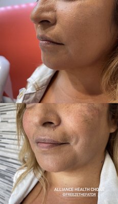 ALLIANCE HEALTH CHOICE - Updated April 2025 - 357 Photos & 624 Reviews ...