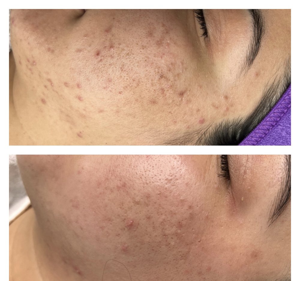 UNBLEMISHED SKIN STUDIO - Updated December 2025 - 100 Photos & 15 ...