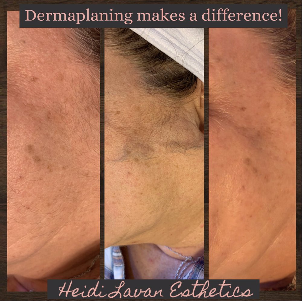 HEIDI LAVAN ESTHETICS - Updated June 2024 - 3312 Princess Anne Rd ...