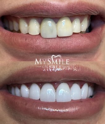 MY SMILE CENTER - Updated October 2025 - 15 Photos - 12800 SW 8th St ...