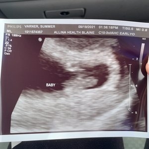 ALLINA HEALTH FOREST LAKE CLINIC - Updated May 2025 - 16 Photos & 10 ...