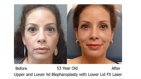 ELTRASELF - Updated February 2026 - 31 Photos & 23 Reviews - 254 ...