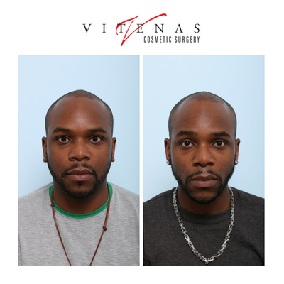 VITENAS COSMETIC SURGERY - Updated October 2025 - 177 Photos & 80 ...