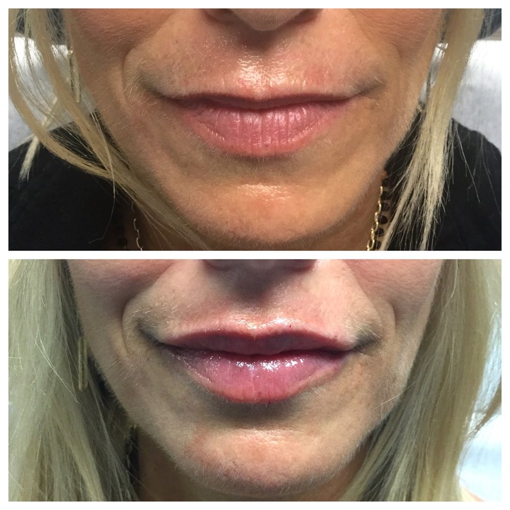 MITCHELL DERMATOLOGY - Updated July 2025 - 17 Photos & 10 Reviews - 815 ...