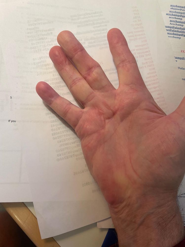 KEITH DENKLER, MD - Updated January 2026 - 14 Photos & 73 Reviews - 275 ...