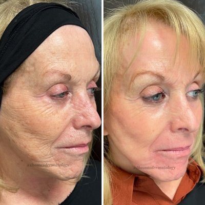 THOMAS DERMATOLOGY - Updated January 2026 - 62 Photos & 310 Reviews ...