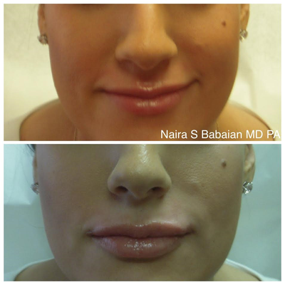 NAIRA S. BABAIAN, MD - Updated January 2026 - 15 Photos & 18 Reviews - 5928 W Parker Rd, Plano ...