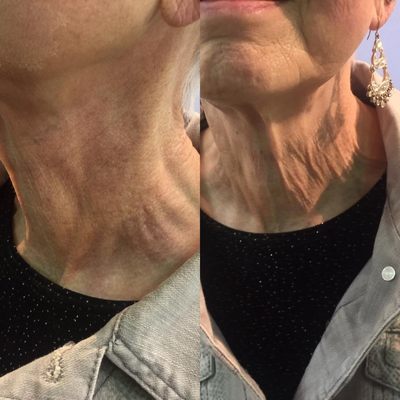 LILLY BEAUTY MEDICAL SPA - Updated March 2025 - 47 Photos & 89 Reviews ...