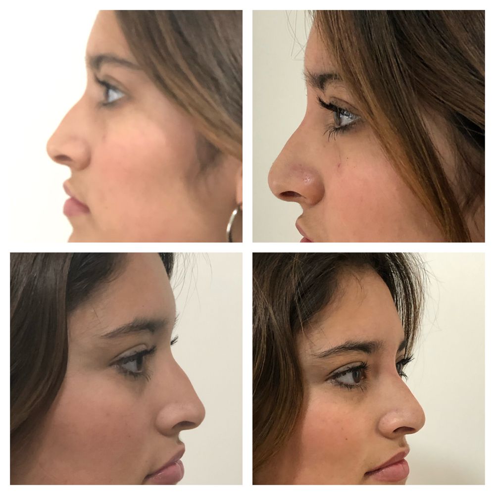 O’LIFE - 164 Photos & 14 Reviews - Day Spas - Schiller 213-4, Ciudad de ...