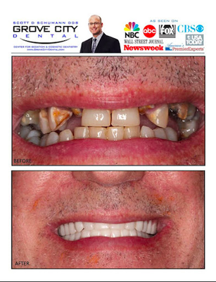 GROVE CITY DENTAL - Updated August 2025 - 199 Photos & 27 Reviews ...