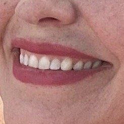 FIRST STREET DENTAL GROUP - Updated May 2026 - 38 Photos & 88 Reviews ...