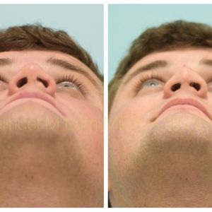 ROD ROHRICH, MD - Updated April 2025 - 14 Photos & 33 Reviews - 9101 N ...