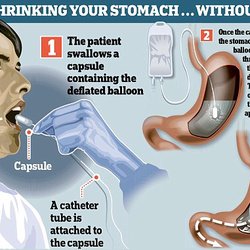 SHAHROOZ BEMANIAN, MD, FACP - 13 Photos & 62 Reviews - 113 Waterworks ...