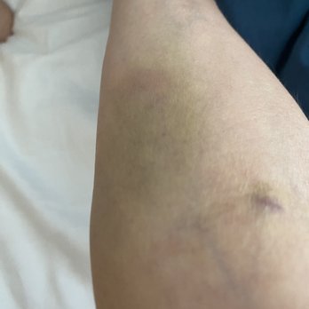 LABCORP - Updated January 2026 - 15 Photos & 12 Reviews - 1317 3rd Ave ...