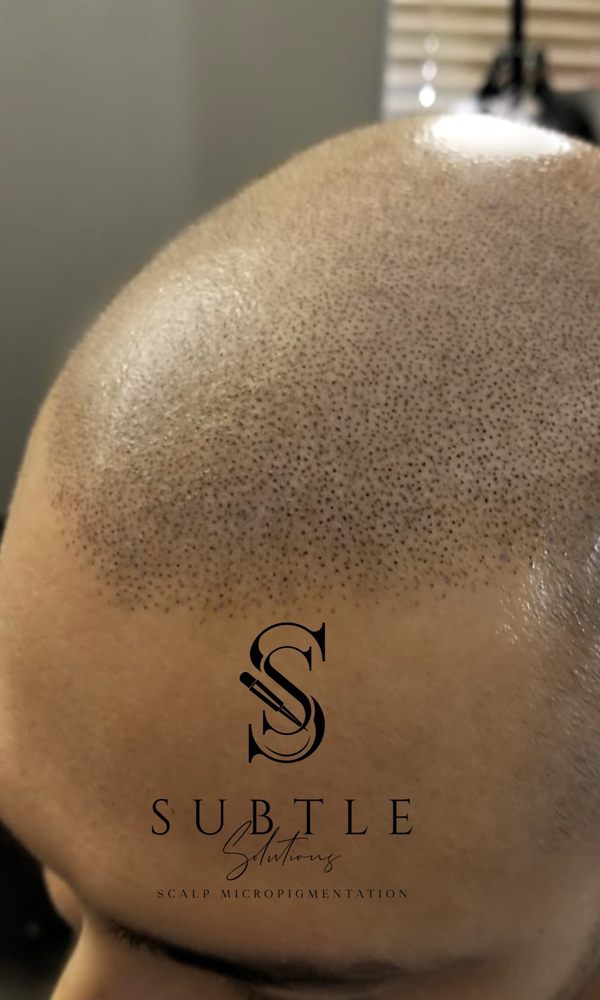SUBTLE SOLUTIONS SCALP MICROPIGMENTATION - 25 Photos - 3815 E Bell Rd ...
