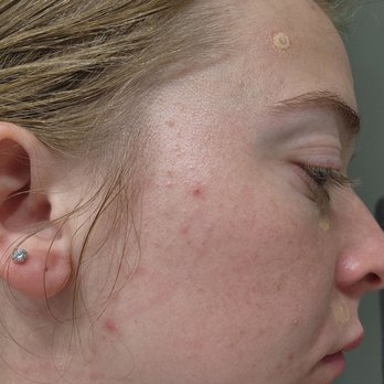 HI, SKIN - Updated September 2025 - 58 Photos & 74 Reviews - 100 E ...