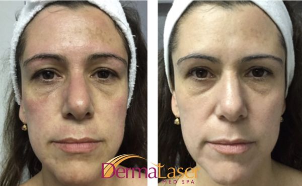 DERMALASER MED SPA - Updated October 2025 - 67 Photos & 29 Reviews ...