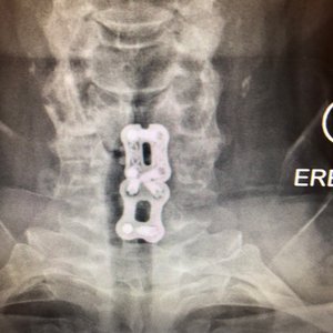 UPRIGHT MRI OF CHERRY HILL - Updated October 2025 - 26 Reviews - 701 Rt ...