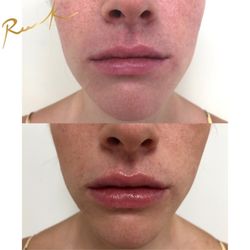 RUSSAK DERMATOLOGY CLINIC & RUSSAK+ AESTHETIC CENTER - 30 Photos & 78 ...