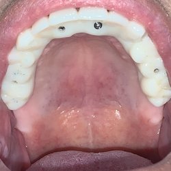 BIONIC SMILE - 25 Photos - Las Vegas, Nevada - Cosmetic Dentists ...