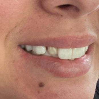 CG SMILE - Updated January 2026 - 74 Photos & 69 Reviews - 2601 SW 37th ...